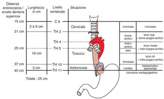 Che cosa è l'esofago: cenni anatomici > Chirurgia Toscana - Dr ...